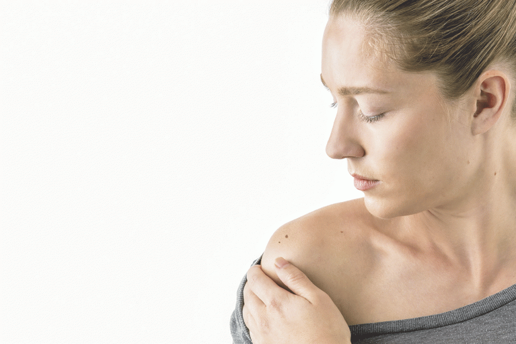 Is fair skin more susceptible to skin cancer? - Country Folks